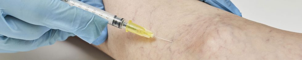 Sclerotherapy | Thread Vein Treatment | The Skin Specialist Nurse